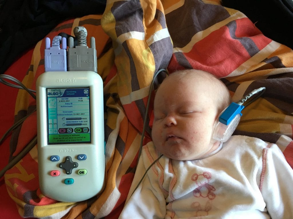 AABR-screening gehoortest baby thuis afnemen- Meervanmir.eu