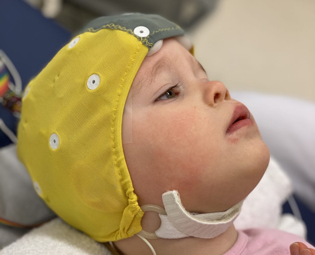 EEG bij een kind om epilepsie: dit kan je verwachten - MeerVanMir