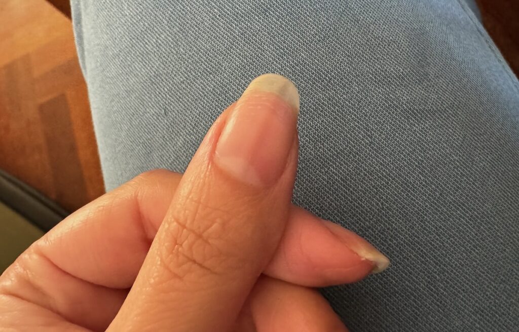 Een streep op je nagel moet je nooit negeren! - MeerVanMir